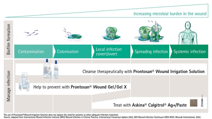 Infected Wounds: Prevention and Treatment