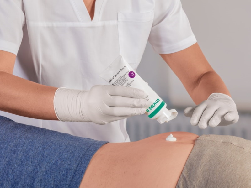 Skin Disorders: Prevention of Skin Breakdown